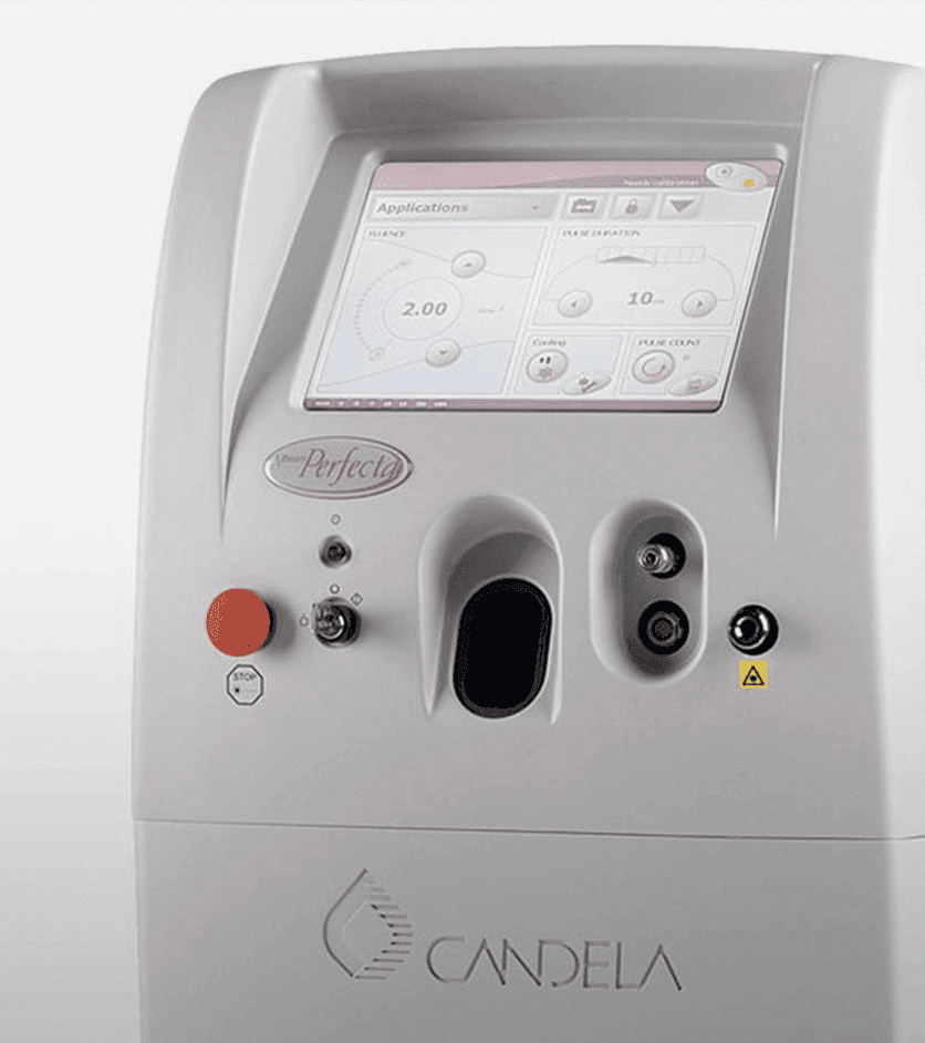 Vbeam Laser treatment Calgary | Rejuvenation Calgary North | Danny Guo MD